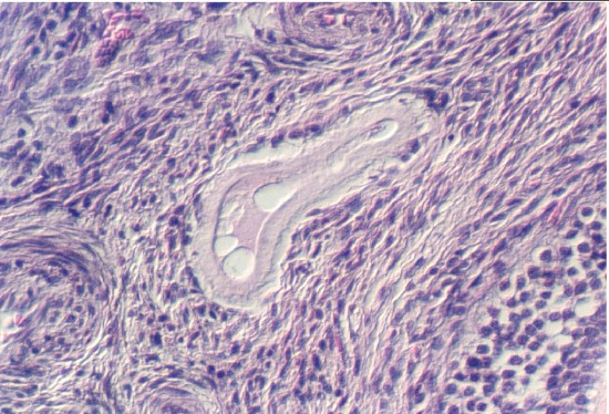 Lab Exercises- Ovary, preovulation